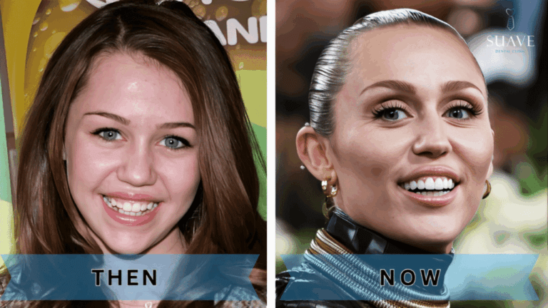 Miley Cyrus's teeth and smile transformation over the years